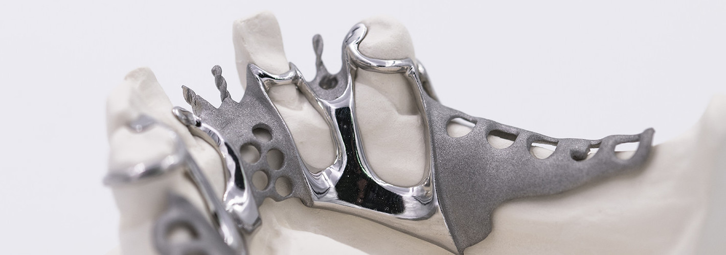 Legure, livenje – Interdent